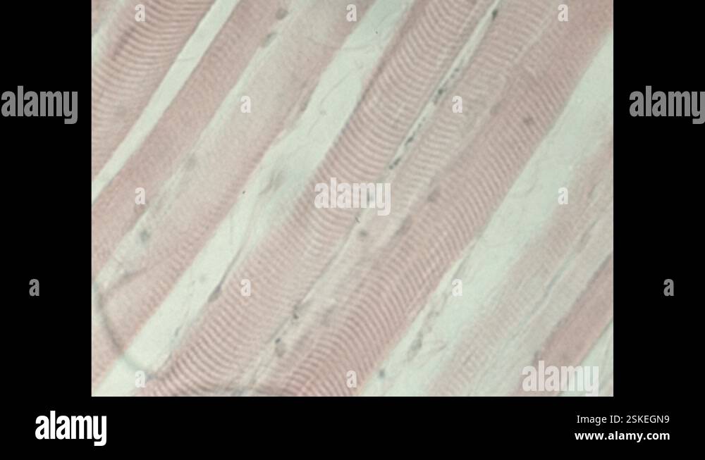 1960s: Skeletal muscle under microscope Stock Video Footage - Alamy