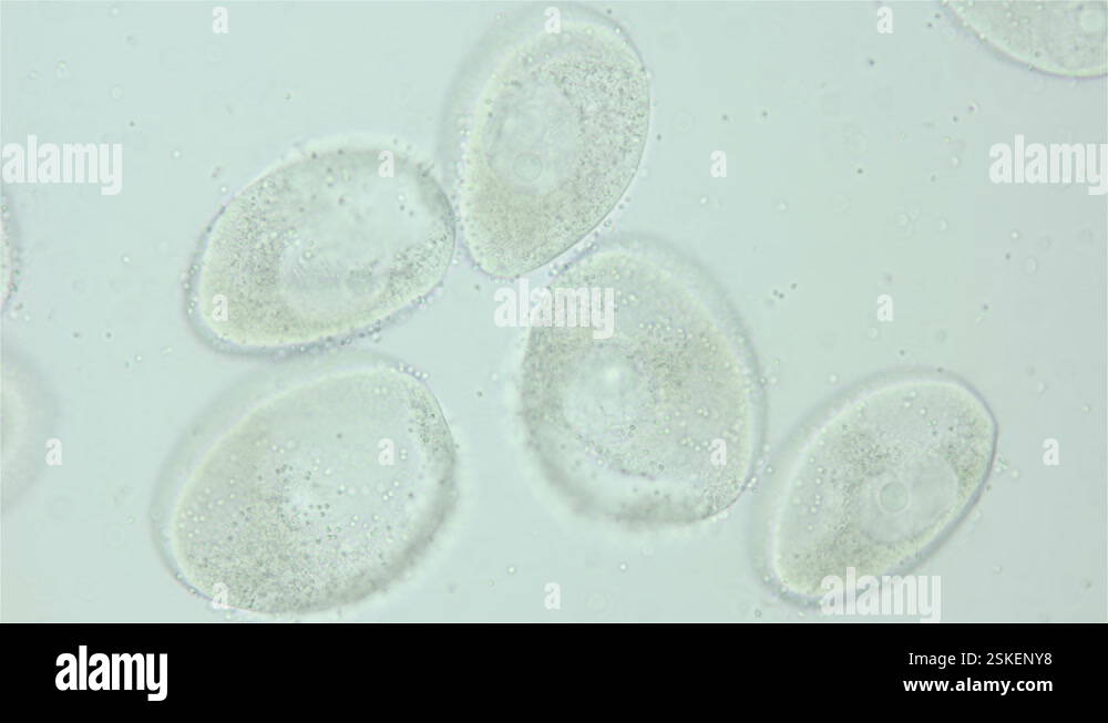 Sperm and ovule of worm Polychaeta Ophelia limacina under microscope ...