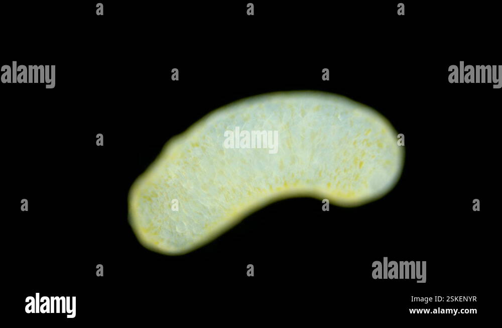 Sporocyst stage of parasitic worm Podocotyle sp. under microscope ...
