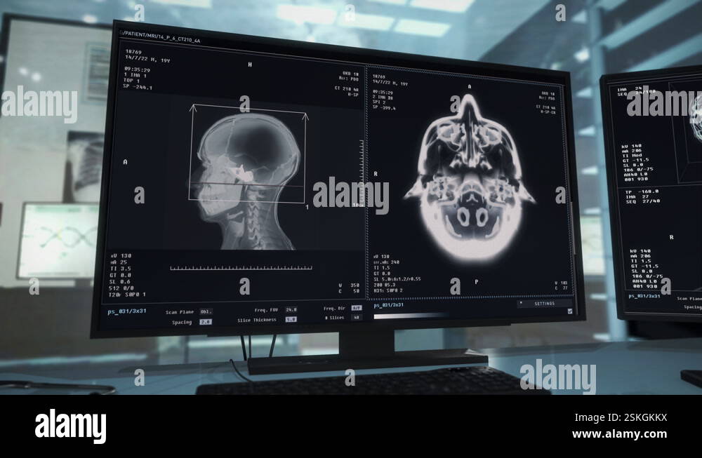 Examining the head imaging data to locate the dangerous brain ...