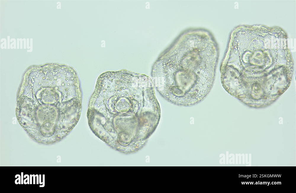 Larvae sea urchin Strongylocentrotus pallidus under microscope ...