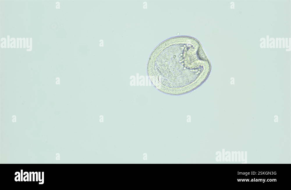 Larvae sea urchin Strongylocentrotus pallidus under microscope ...