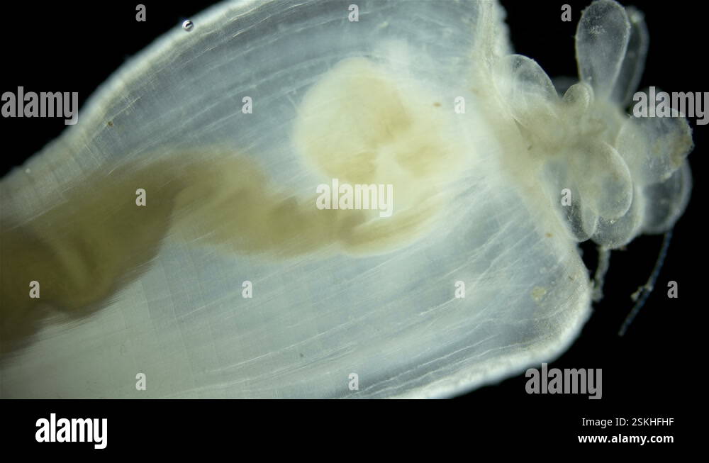 Cactus worm Priapulus caudatus under microscope, phylum Priapulida ...