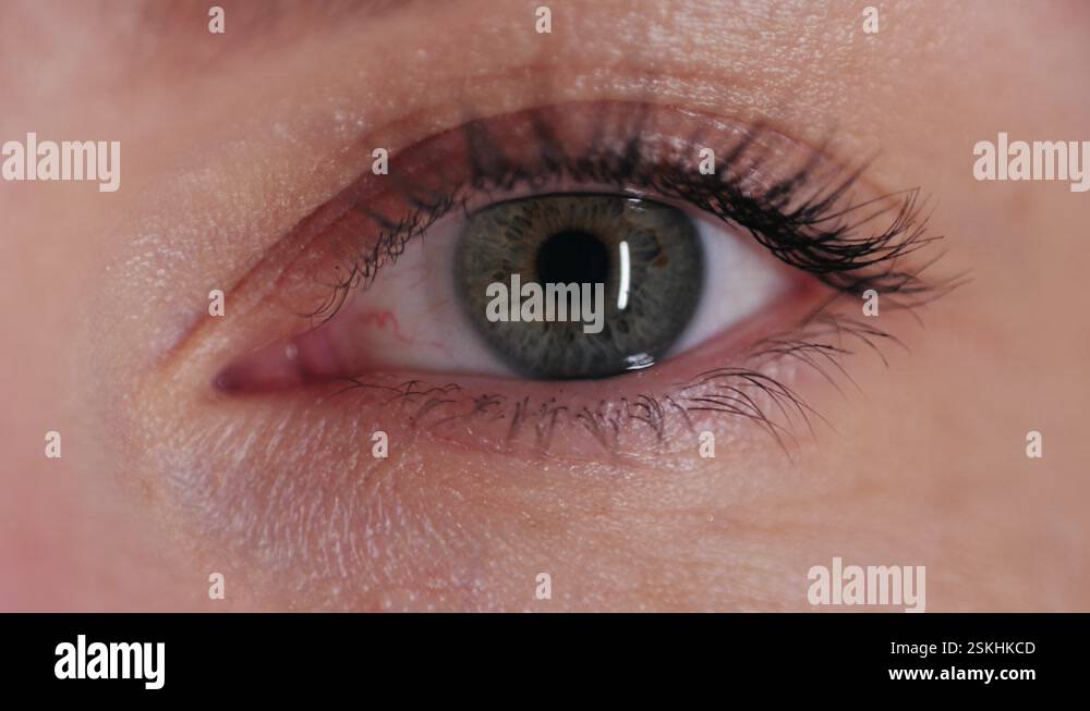 Eye damage Stock Videos & Footage - HD and 4K Video Clips - Alamy