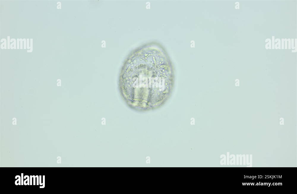 Larvae sea urchin Strongylocentrotus pallidus under microscope ...