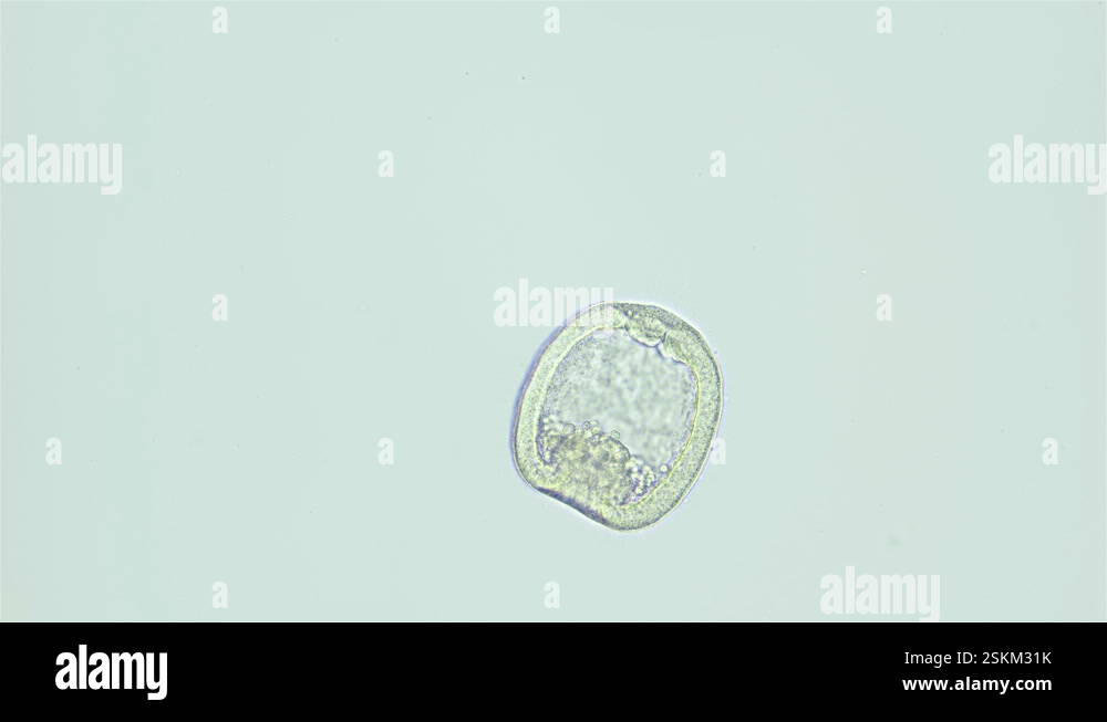 Larva sea urchin Strongylocentrotus pallidus under microscope ...