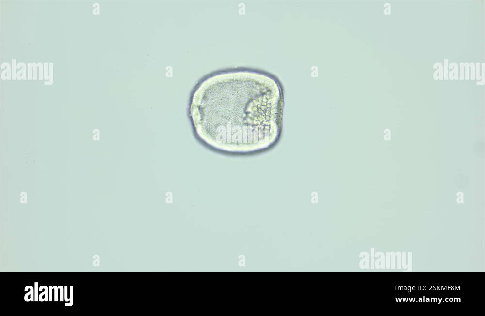 Larva sea urchin Strongylocentrotus pallidus under microscope ...