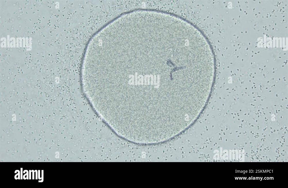 Sperm and ovule sea urchin Strongylocentrotus pallidus under microscope ...