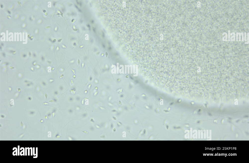 Sperm and ovule sea urchin Strongylocentrotus pallidus under microscope ...