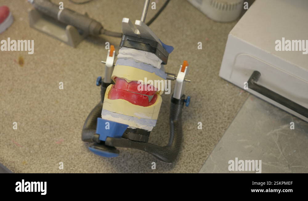 Manufacturing the artificial gum prosthetic models at a dentistry ...