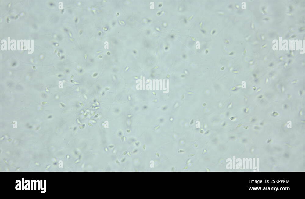 Sperm sea urchin Strongylocentrotus pallidus under microscope, phylum ...
