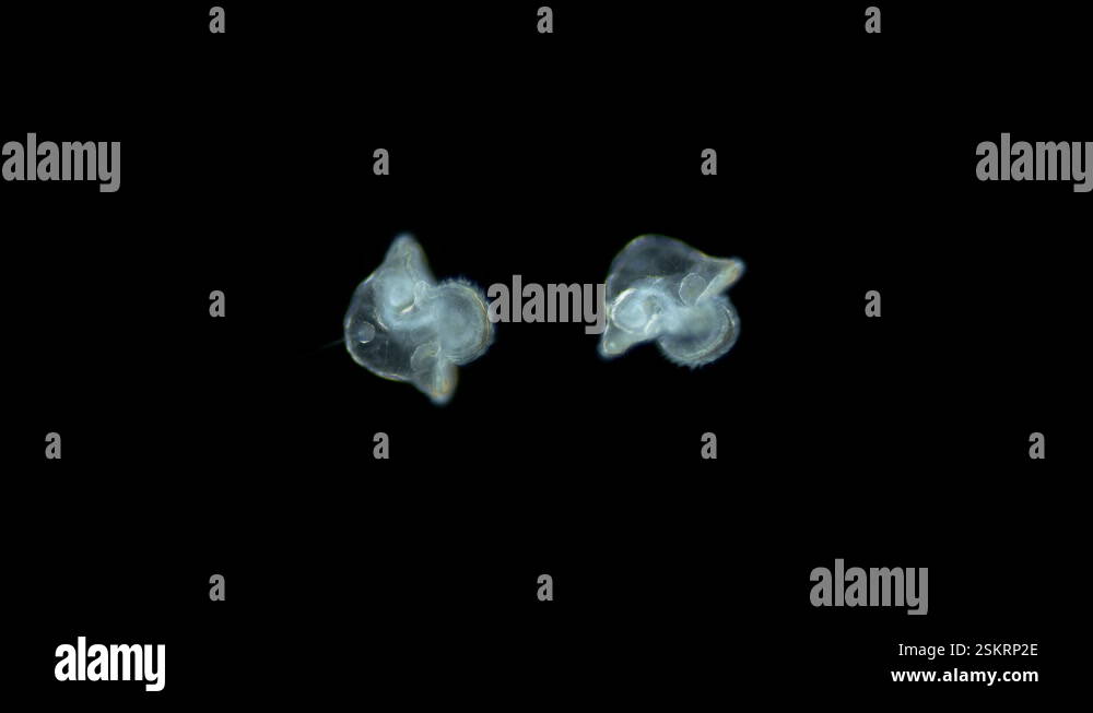 Pilidium larva of worm Heteronemertea under microscope, genus ...