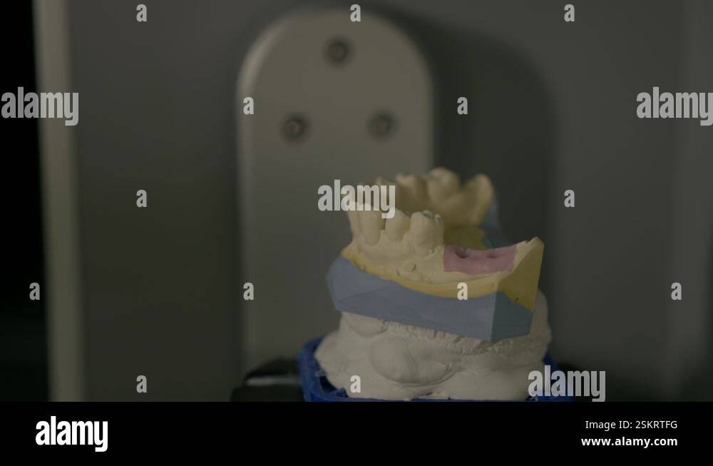 Artificial Teeth Rotated Using CAD Dental Scanner For Denture ...