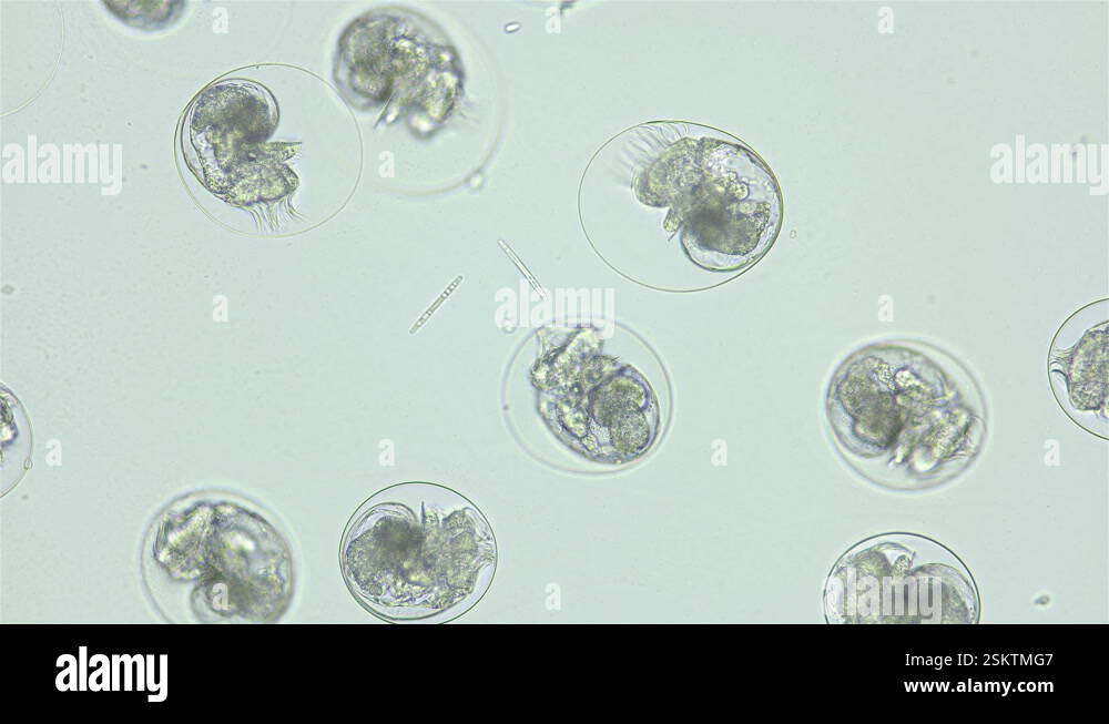 Larvae veliger Mollusca in a clutch of eggs under microscope, class ...