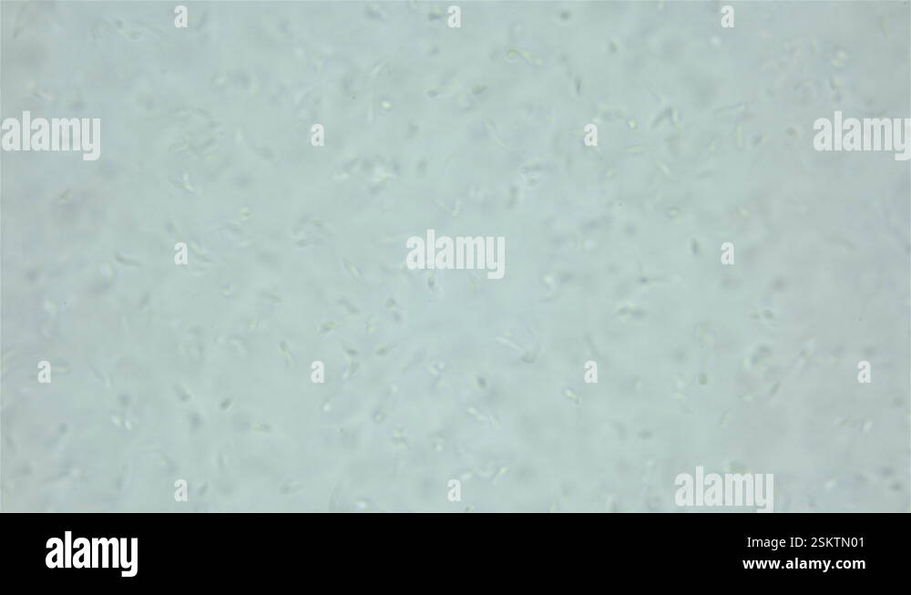 Sperm sea urchin Strongylocentrotus pallidus under microscope ...