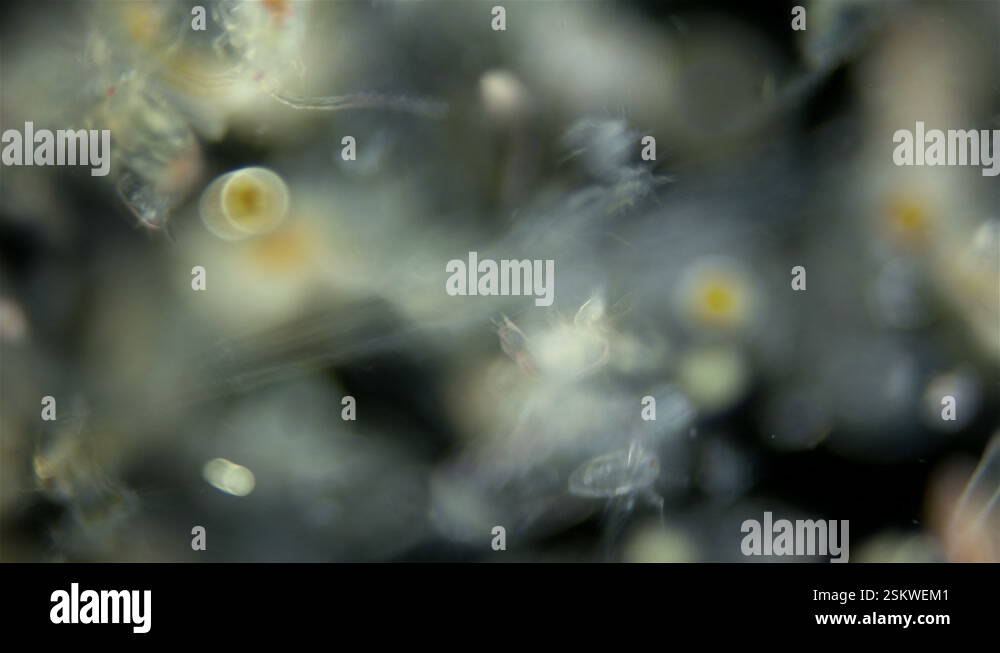 Zooplankton and plankton of White Sea under a microscope Stock Video ...
