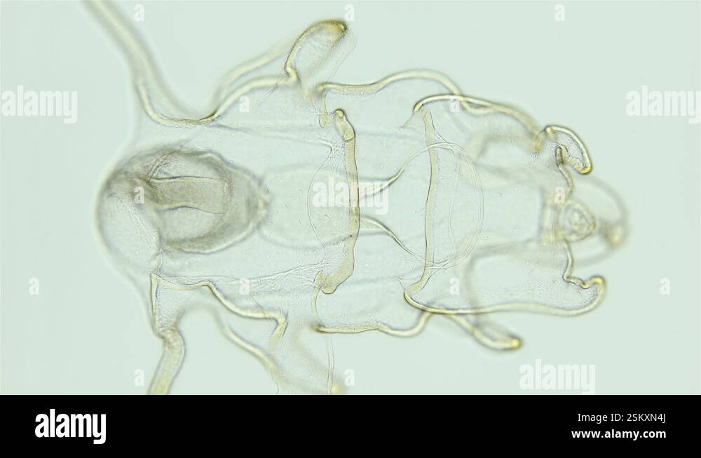 Larva of starfish family Asteriidae under microscope, possible Asterias ...