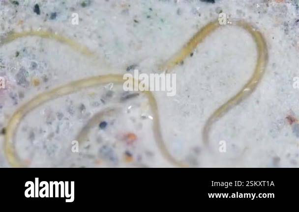 Macro footage of Pontonema vulgare nematode worms. Filmed in the White Sea Stock Video Footage ...