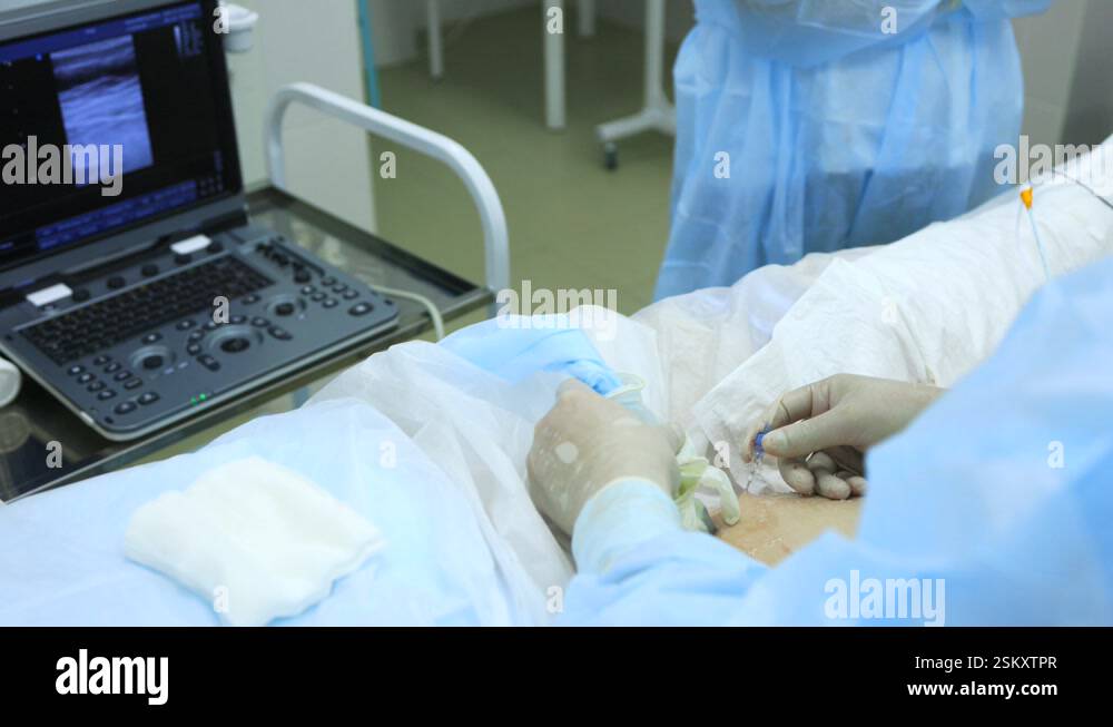 During the operation, the doctor performs an ultrasound examination on ...