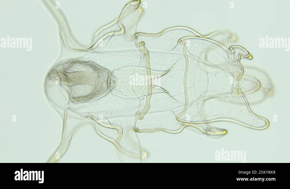 Larva of starfish family Asteriidae under microscope, possible Asterias ...