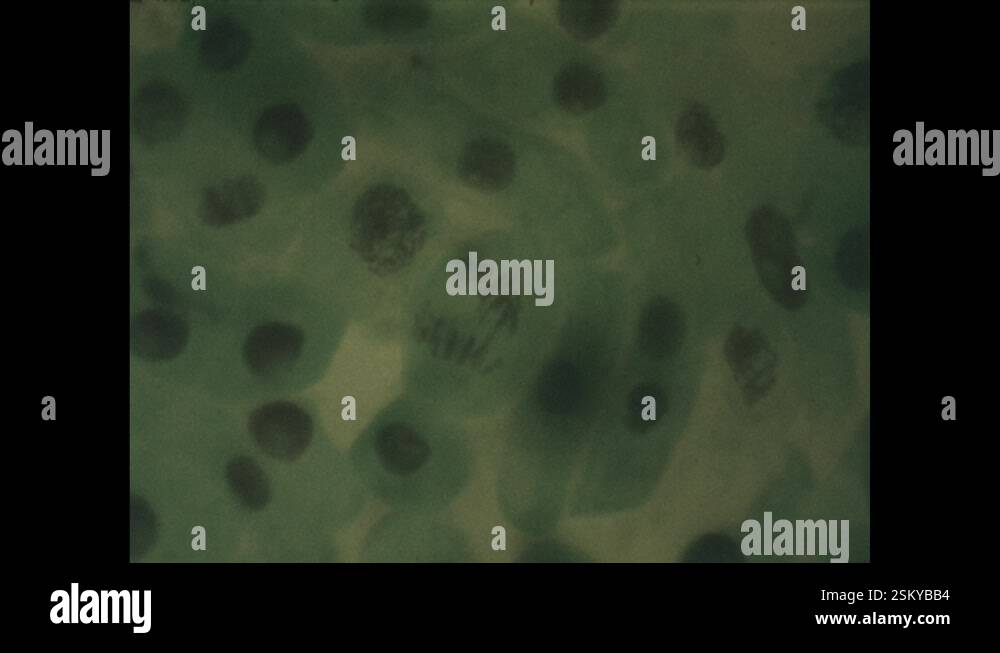 1960s: cells under a microscope with cell nuclei visible, one nucleus ...