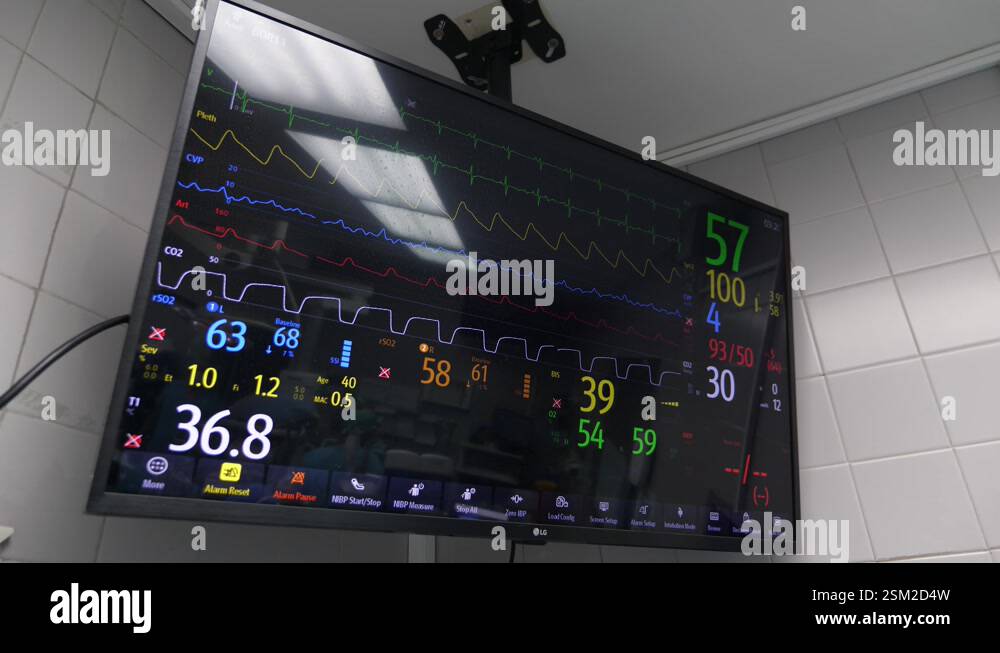 Operating room monitor displaying heart rate and blood pressure Stock ...