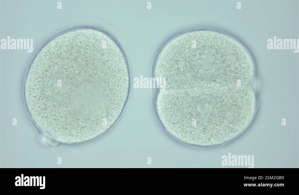 Fertilized egg of worm Ophelia limacina under microscope. Stage is one ...