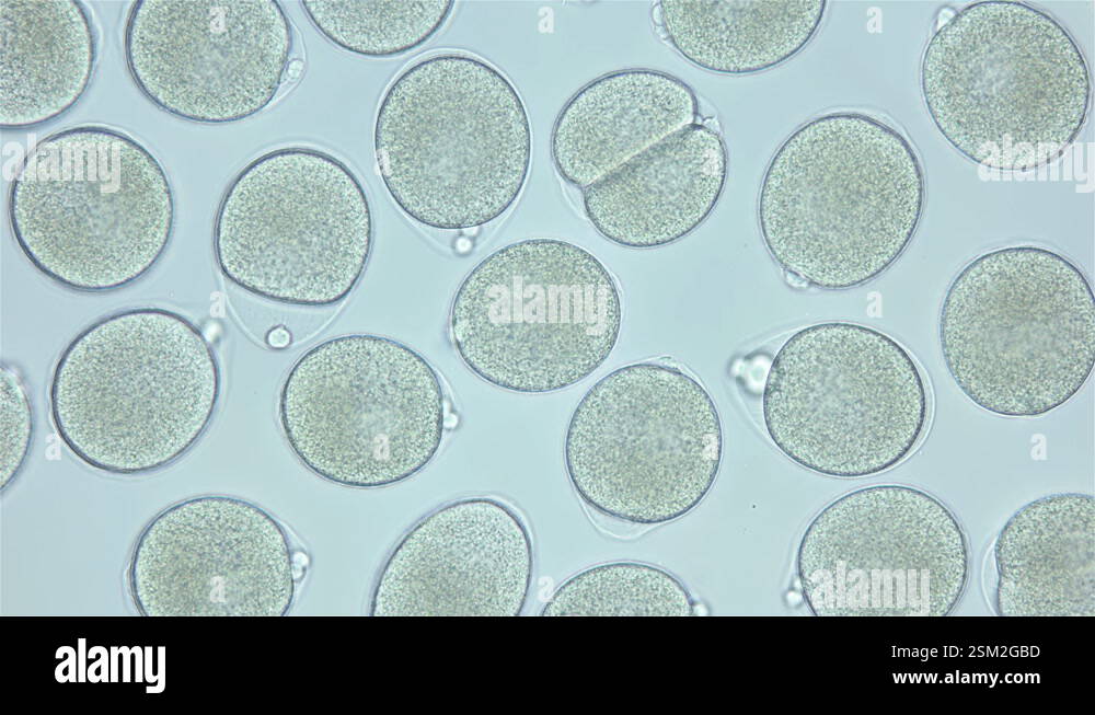 Fertilized egg of worm Ophelia limacina under microscope. Stage is one ...