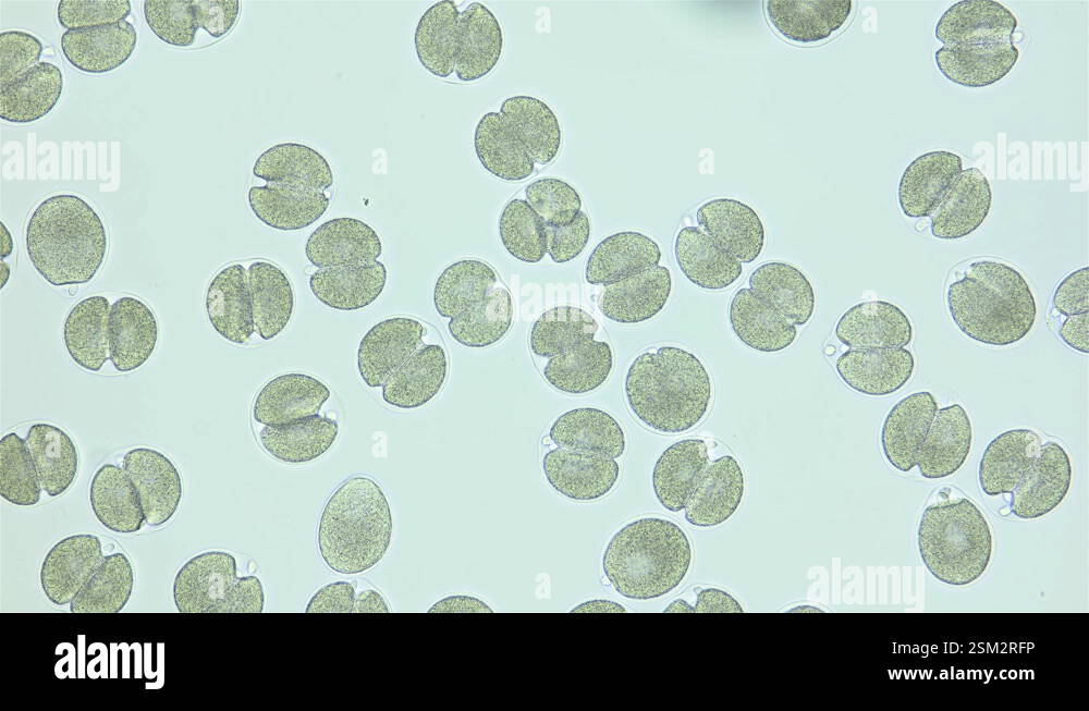 Fertilized egg of worm Ophelia limacina under microscope. Stage is one ...