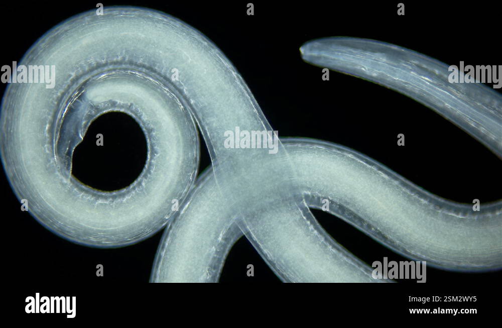 worm Nematoda under microscope, Phylum Protostomia, free-living nematodes Stock Video Footage ...