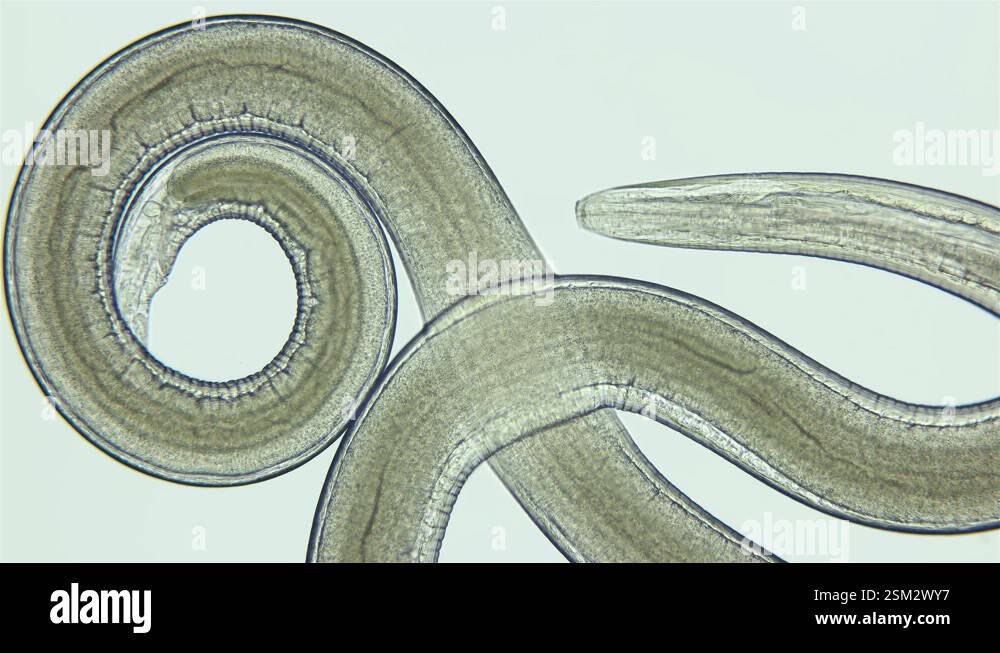 worm Nematoda under microscope, Phylum Protostomia, free-living ...