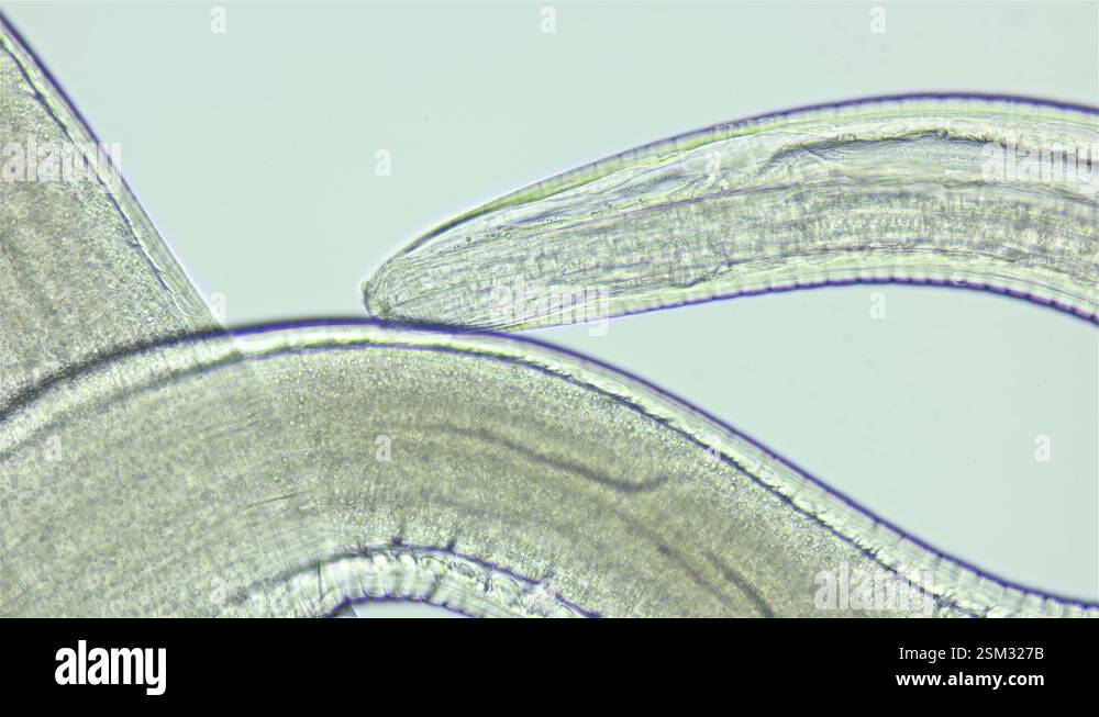 worm Nematoda under microscope, Phylum Protostomia, free-living ...