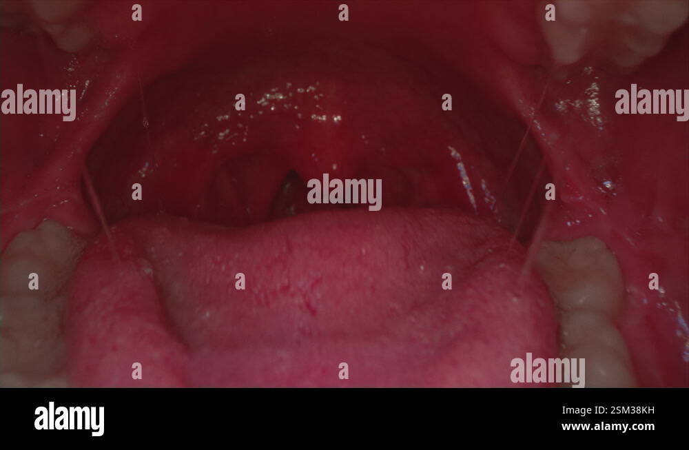 Real human throat. Macro frame inside the mouth. Teeth and jaw, soft ...