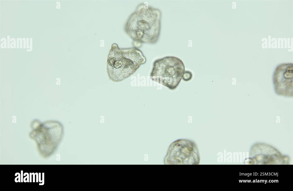 Larvae sea urchin Strongylocentrotus pallidus under microscope ...