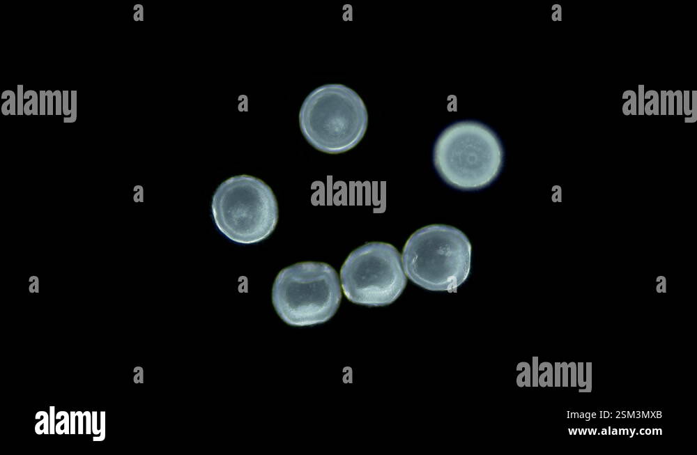 Larva sea urchin Strongylocentrotus pallidus under microscope ...