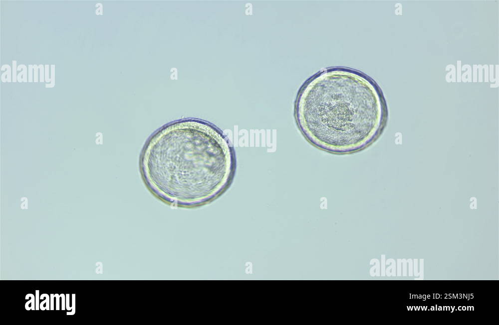 Larva sea urchin Strongylocentrotus pallidus under microscope ...