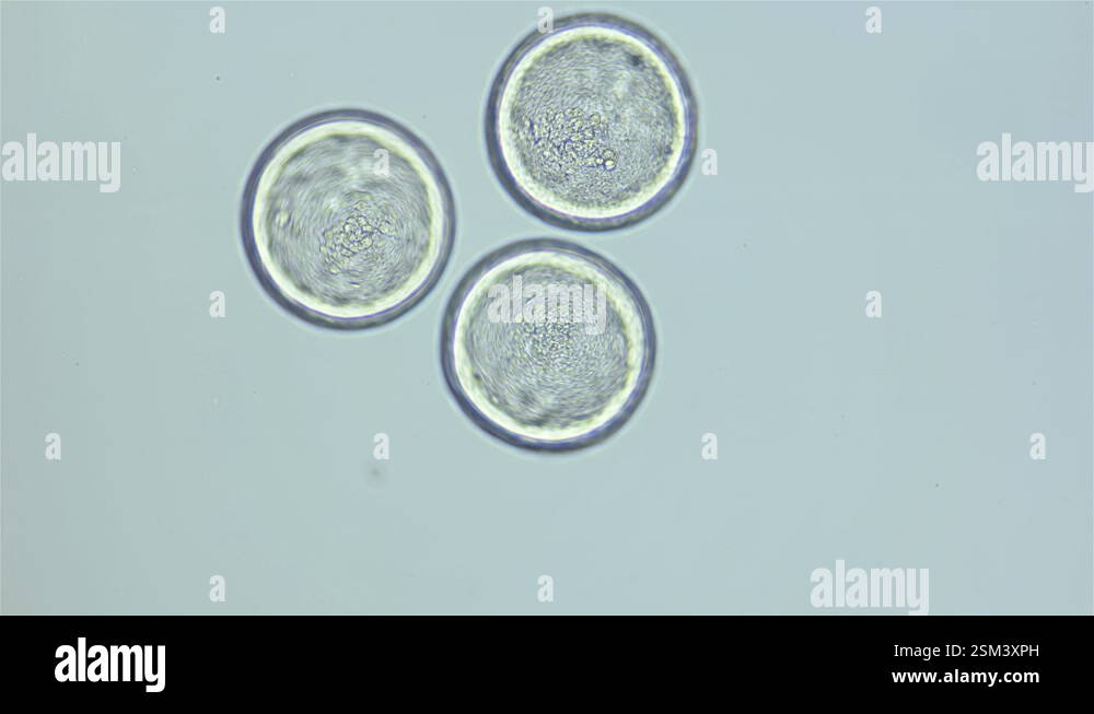 Larva sea urchin Strongylocentrotus pallidus under microscope ...