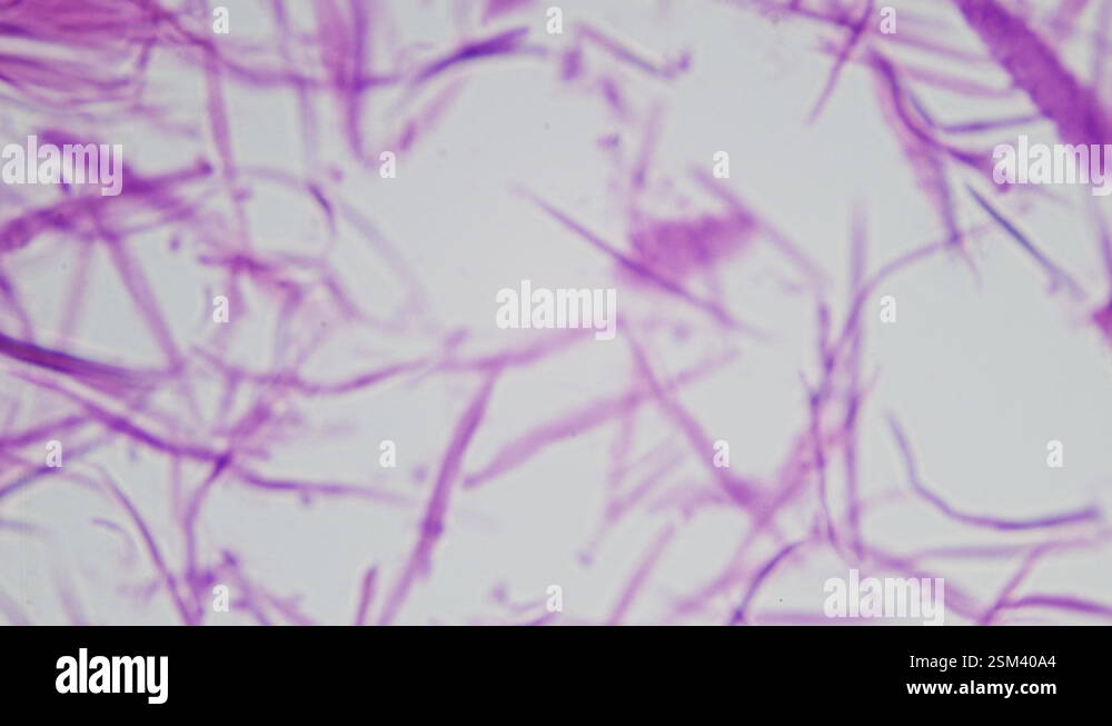 A bundle of human smooth muscle fibers under a microscope. The main ...
