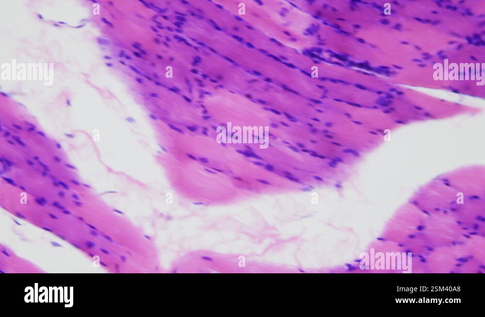 Human skeletal muscle tissue under microscope. Longitudinal section ...