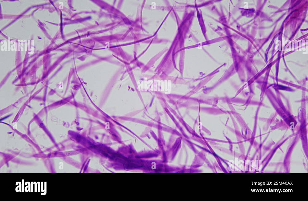 A bundle of human smooth muscle fibers under a microscope. The main ...