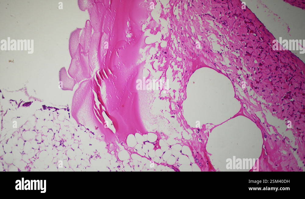 Real specimen of a human vein, multiple magnification under a ...