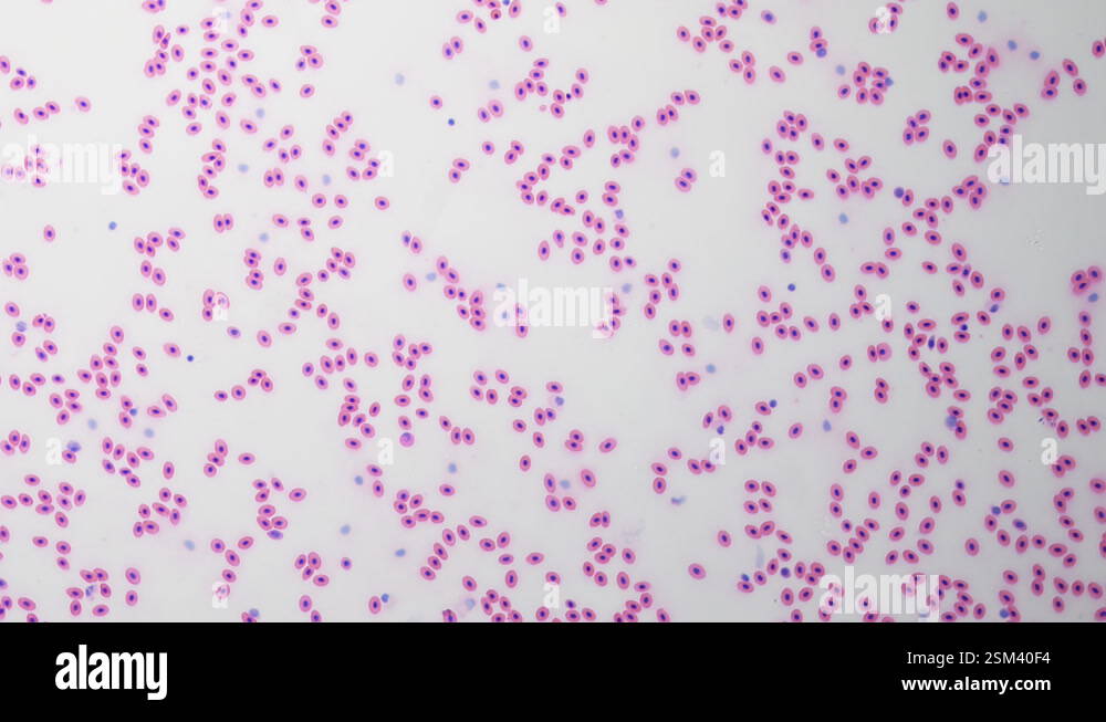 Large and spherical erythrocytes of frog blood. Science class ...