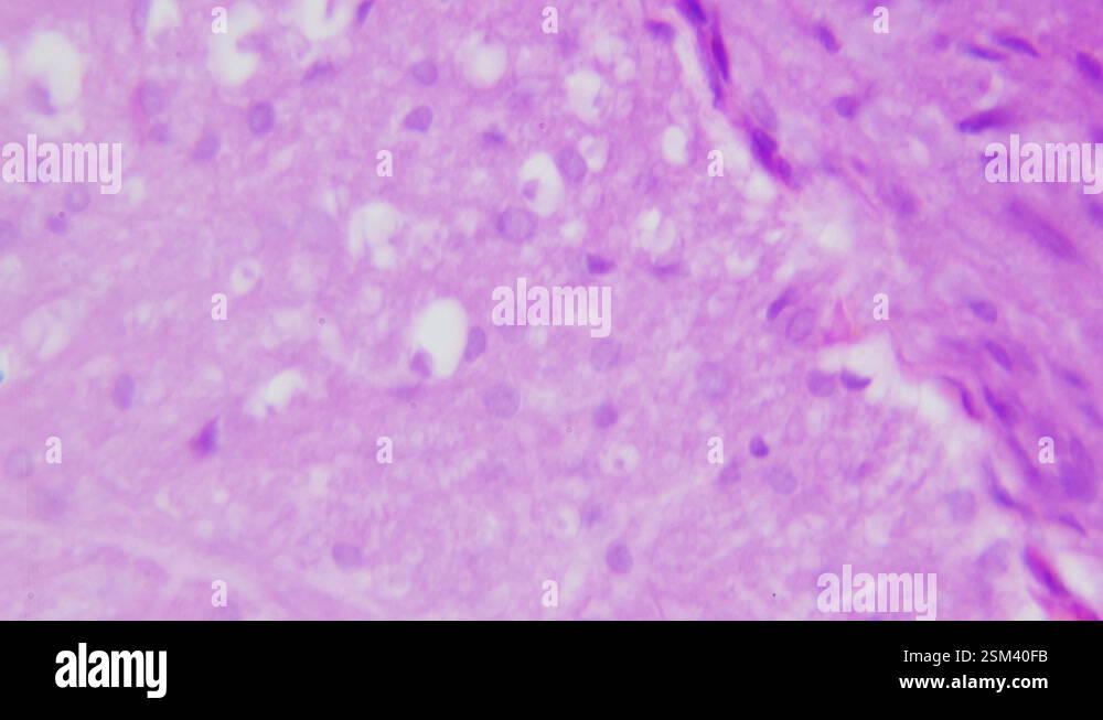 Human nerve bundle under microscope. Cross section. Smooth movement and ...