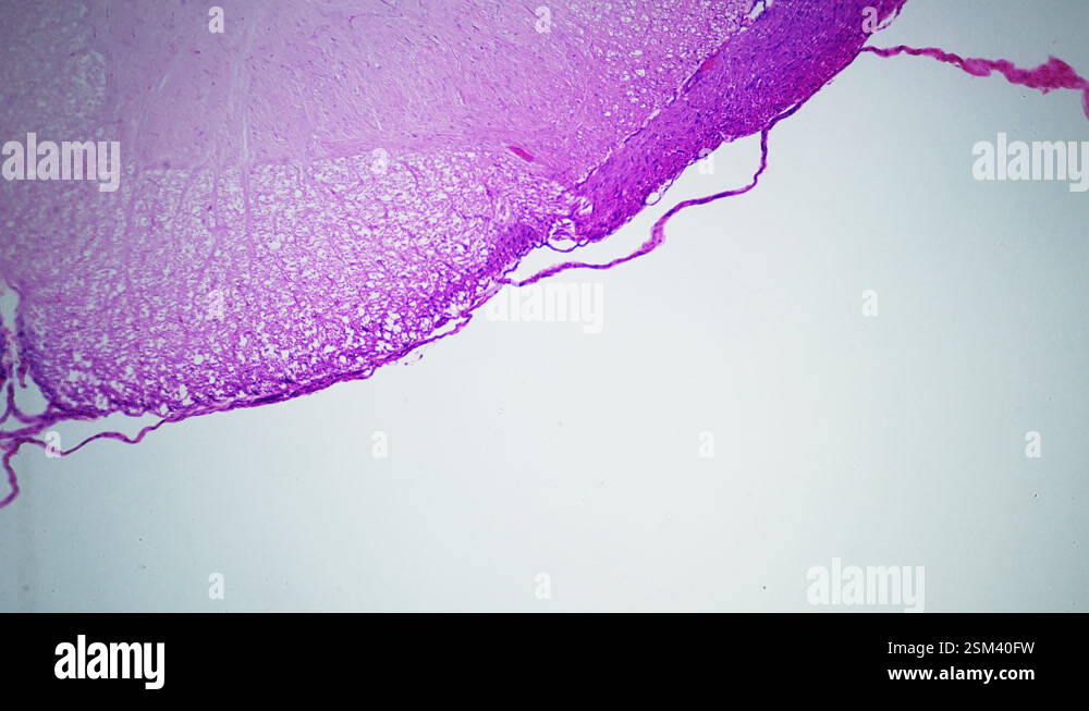 Human nerve fiber bundle under microscope. Cross section. 100x times ...