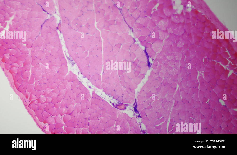 Human skeletal muscle under a microscope. Cross section of the sample ...