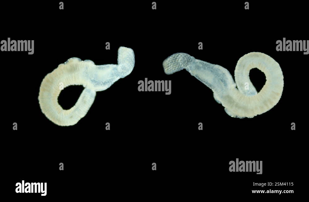 Parasitic worm Echinorhynchus gadi under microscope, phylum Acanthocephala Stock Video Footage ...