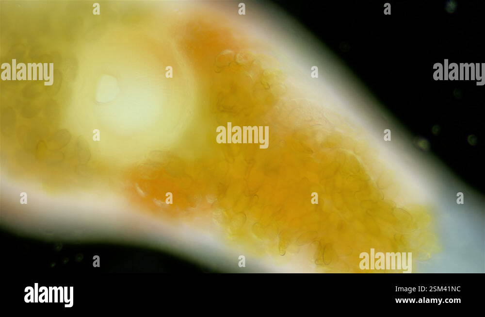Parasitic worm Progonus muelleri under microscope,metacercaria ...
