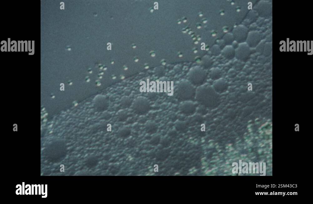 1980s: Cytoplasm flows out from a rupture in a cell membrane. An air ...