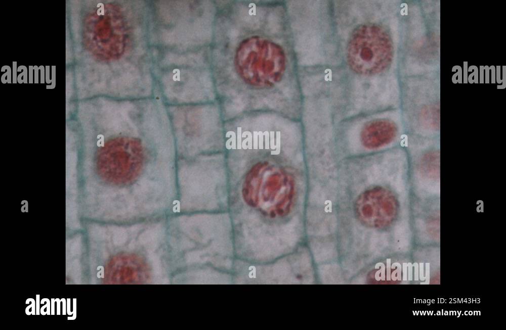 1980s: Plant cells with stained nuclei. Tangle of stained chromosomes ...
