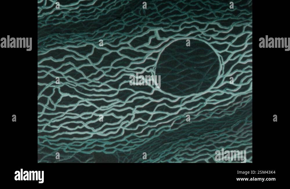 1980s: Protein filaments appear on cell walls under microscope ...